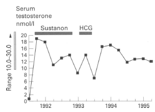 Case study: hCG restores testosterone production after steroids use